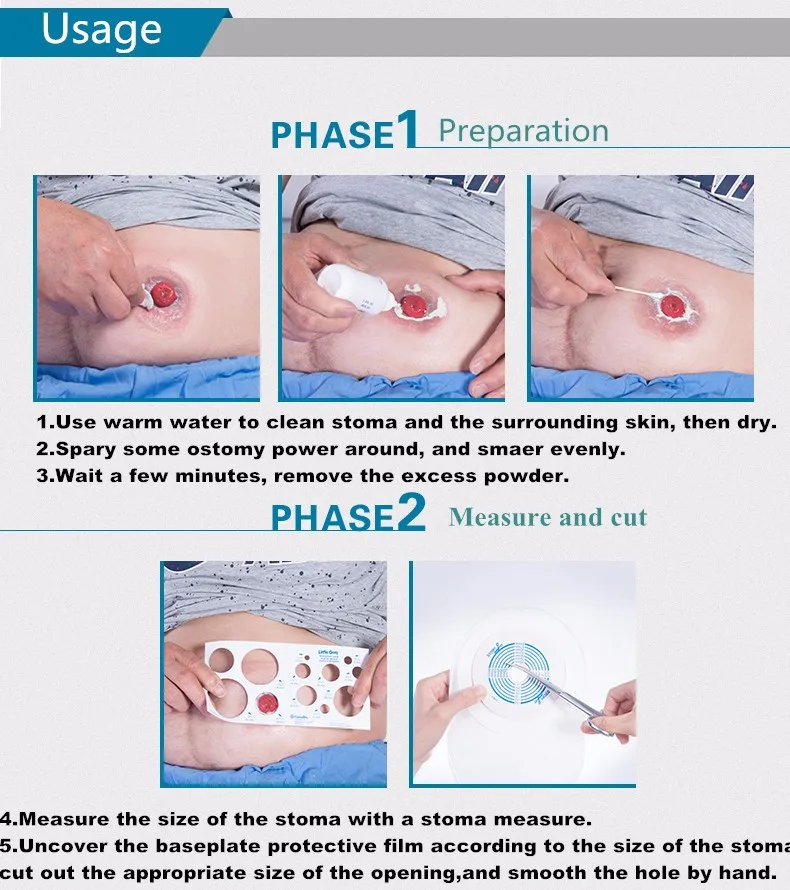 2017 New Product Drainable Stoma Ostomy Colostomy Bag Buy Colostomy