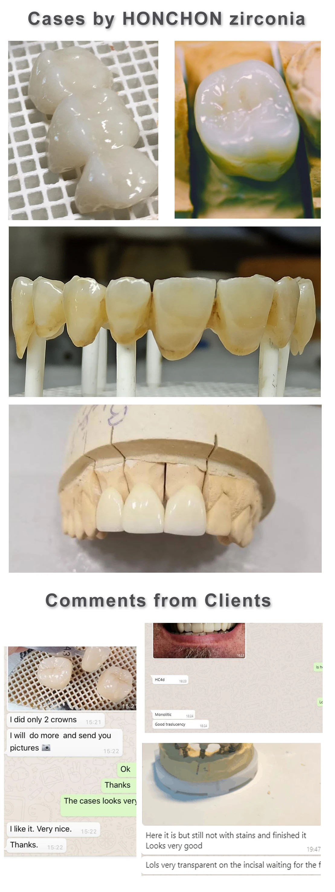 4D Plus Multilayer Zirconium Disc - Strength & Translucency