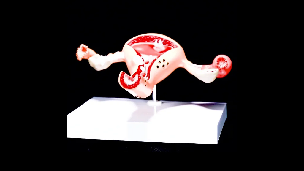 Bix-f5n Female Uterus Contraception Medical Teaching Model For Training ...