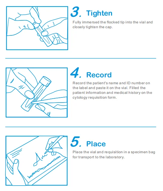 Gynecological Doctor Use Disposable Sterile Vaginal Swab Noninvasive ...