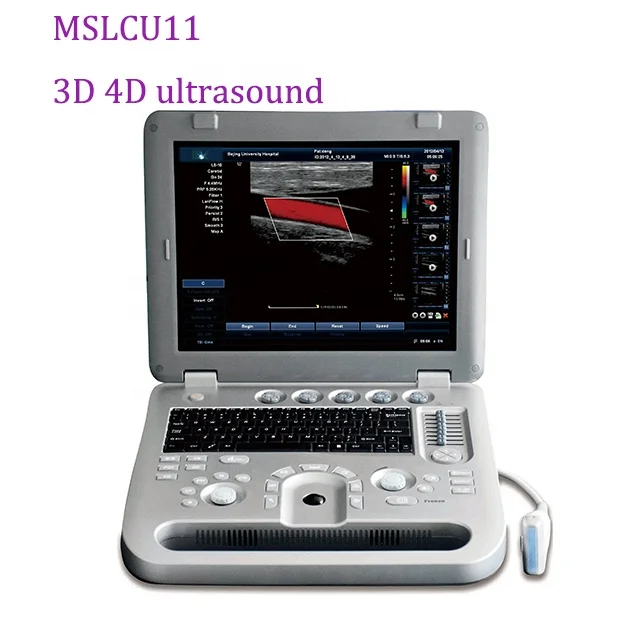 Portable 3d Ultrasound Color Doppler Ultrasound Machine Ultrasonic With ...