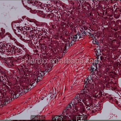 Solarbio Masson's Trichrome Stain Kit - High Quality