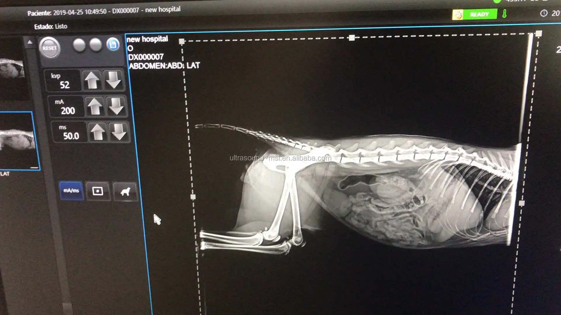 17x17 Wireless FPD for Dr Digital X Ray - MSL Quality