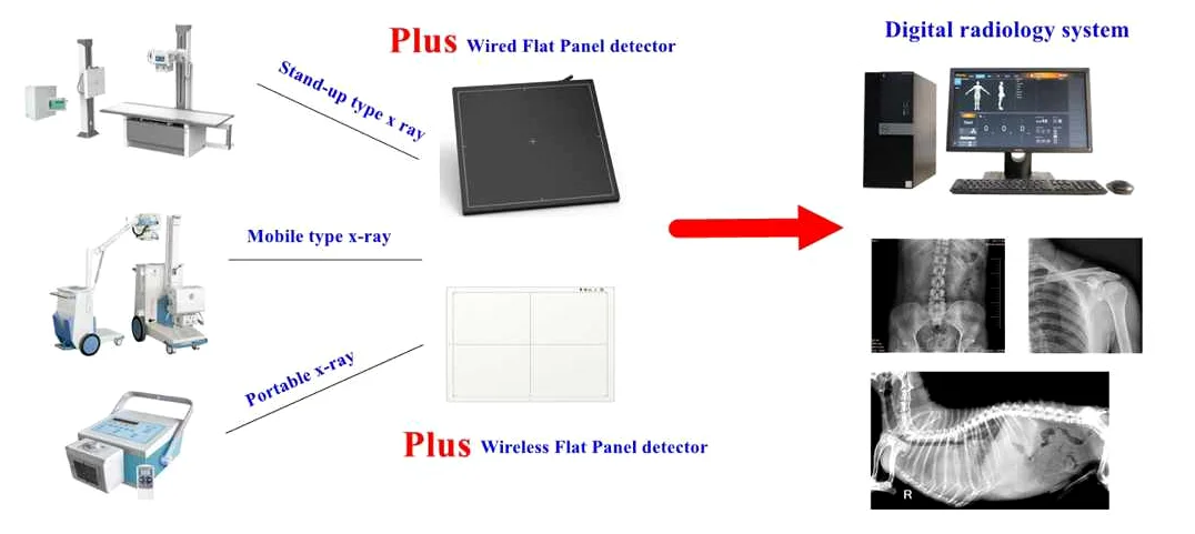 Digital X-ray Diagnosis Equipment X Ray Machine With Toshiba Tube - Buy ...
