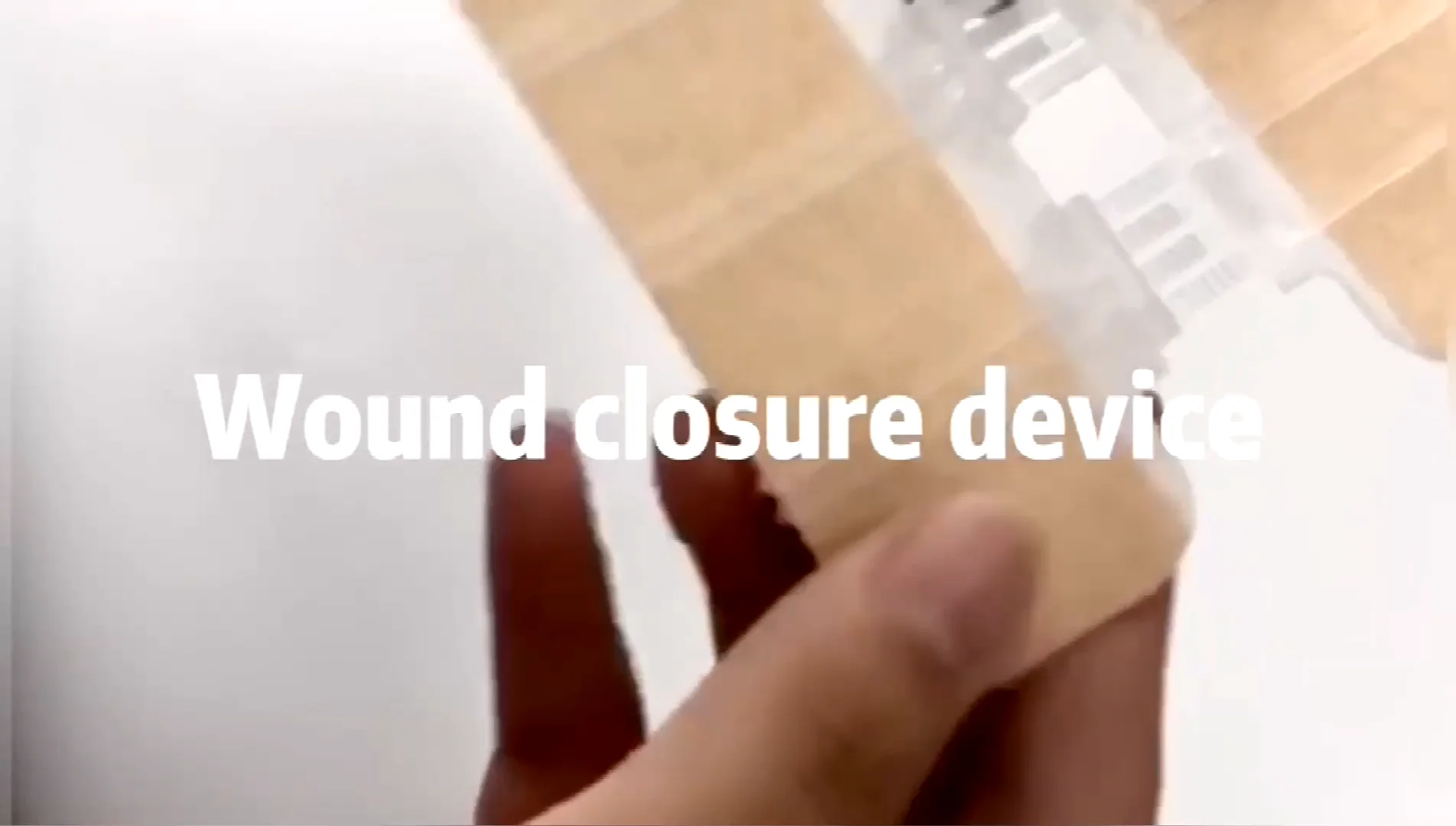 Medical Consumable Medical Zip Line Skin Wound Closure Zipper - Buy ...