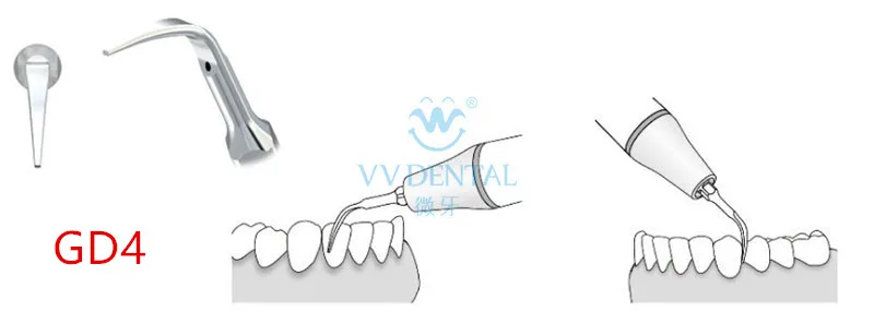 Compatible Satelec/dte Handpiece Gd4 Dental Scaling Detachable Optical ...