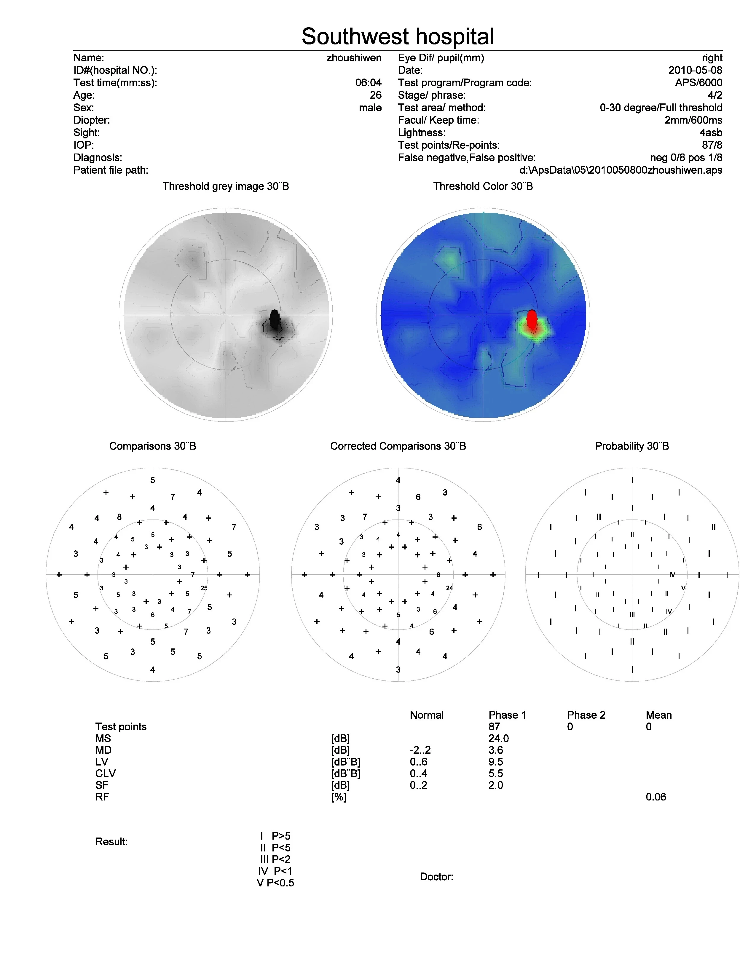 Eye Test Machine - Ophthalmic USB Connection Model APS-6000BER