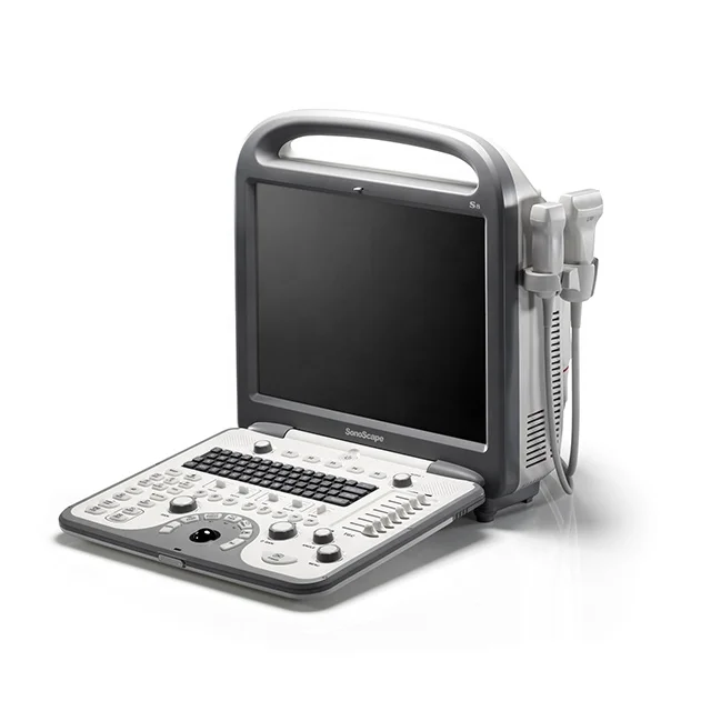Sonoscape Ultrasound Review - Sonoscape S8 Performance
