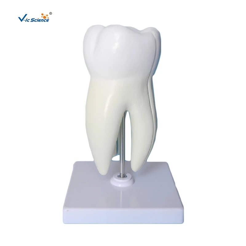 Human Teeth Anatomical Model Molar Tooth Attach With Caries Maxillary ...