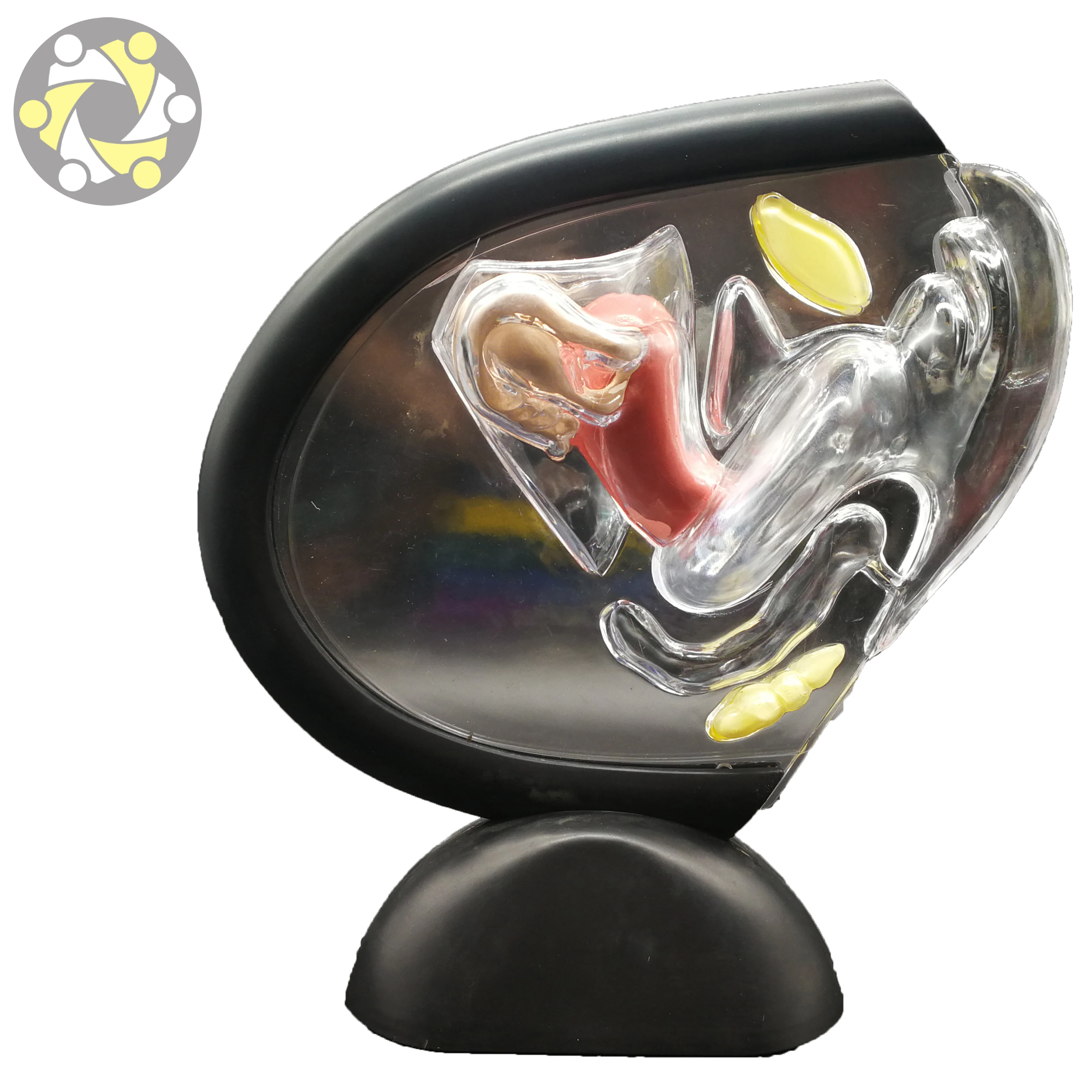 Transparent Uterine Anatomical Model for Medical Education
