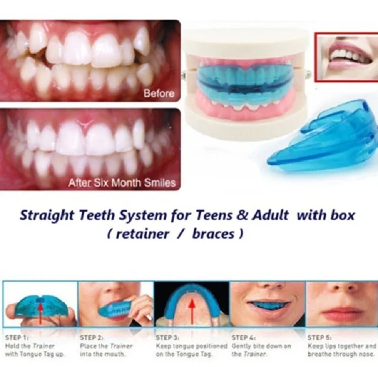 Tooth Orthodontic Teeth Alignment Trainer Appliance,Blue White ...