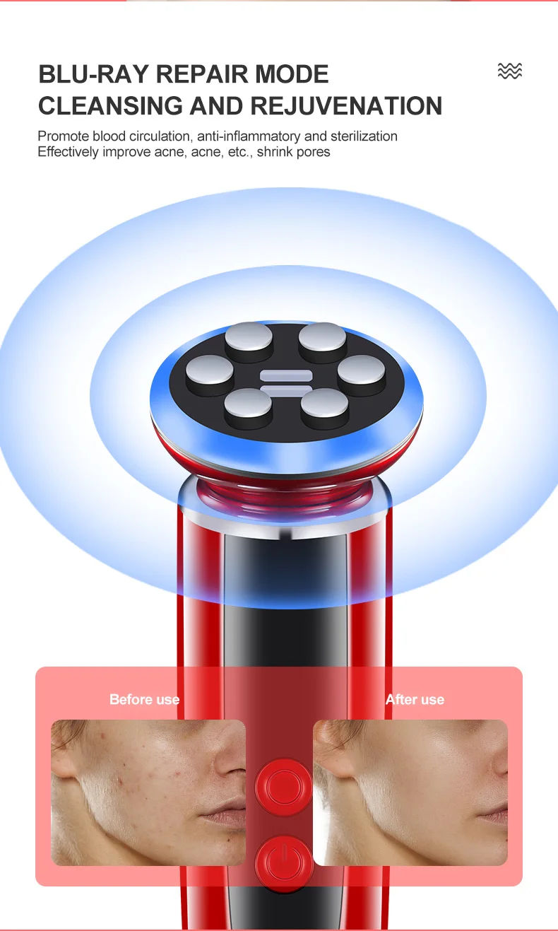 Free Sample Best Rf Device Skin Rejuvenation Tightening Portable Rf ...