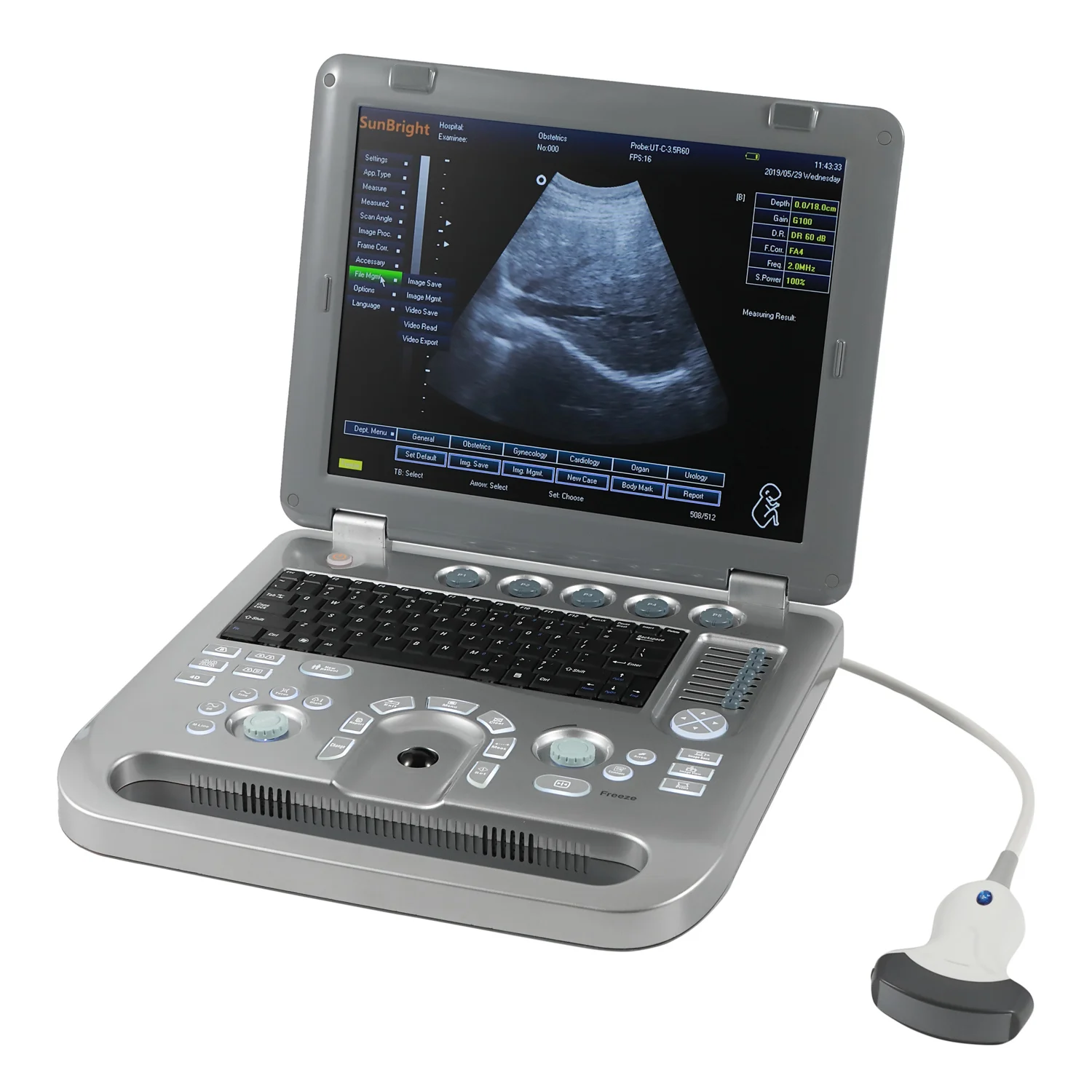 Sunbright Digital Ultrasonography Portable Abdomen Pregnancy Ultrasound ...