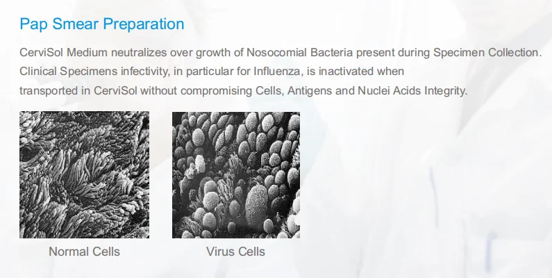 Gynecological Doctor Use Disposable Sterile Vaginal Swab Noninvasive ...