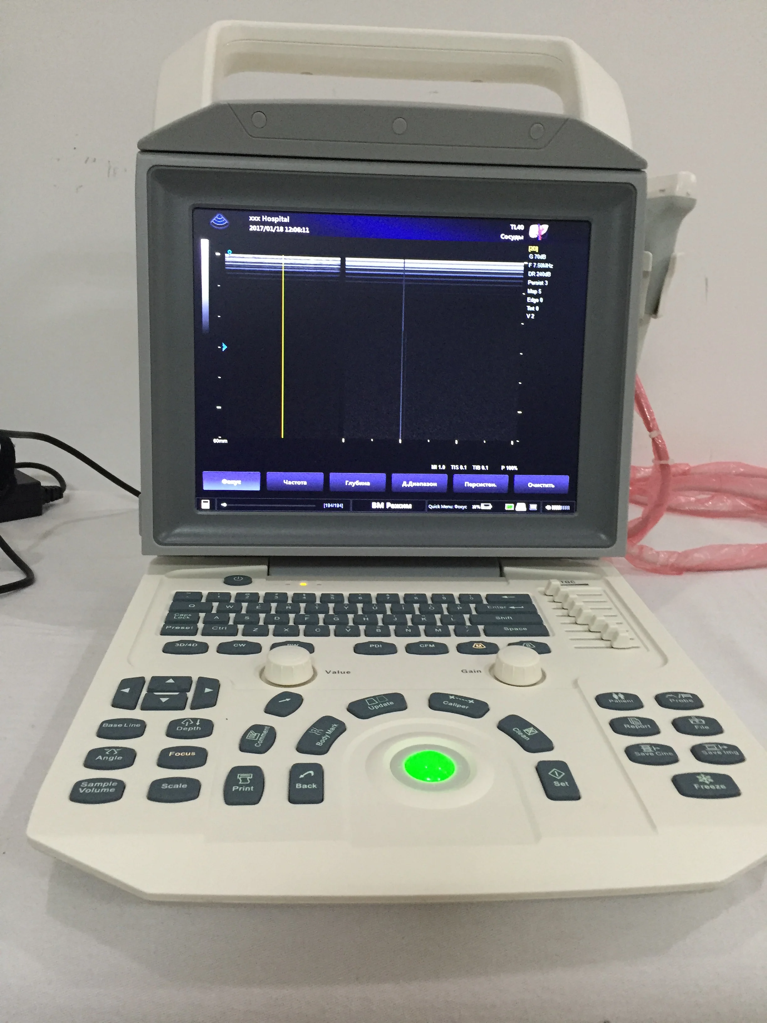 MSL Portable Echo Ultrasound Machine - Abdomen & Color 3D