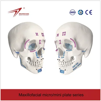 Maxillofacial Titanium Micro/mini Plates Titanium Orthopaedic Implant ...