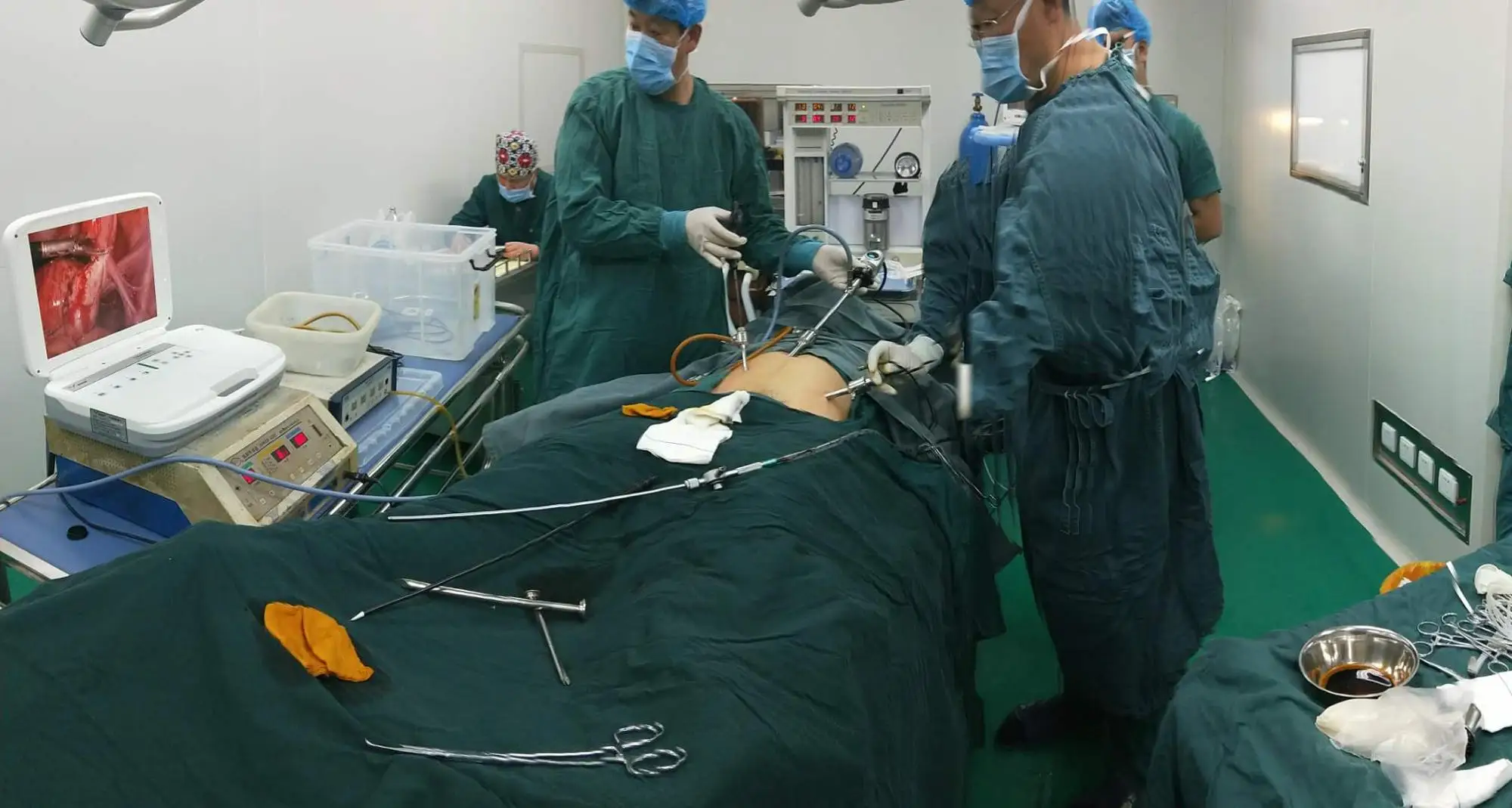 Hdmi Ent Endoscope Camera - Buy Endoscope Camera,Hdmi Endoscope Camera ...