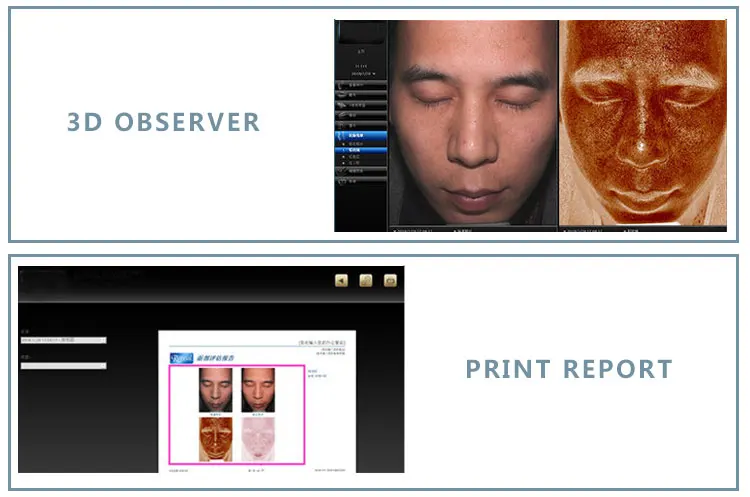 La Peau Du Visage Analyseur 3d Scanner/peau Cheveux Analyseur ...