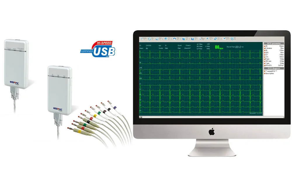 Pc Ecg/ekg Machine Compatible With Windows 10 System - Buy Pc Ecg,Pc ...