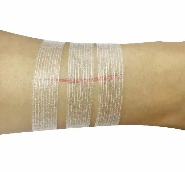 Wound Skin Closure Strips - Transparent Medical Materials