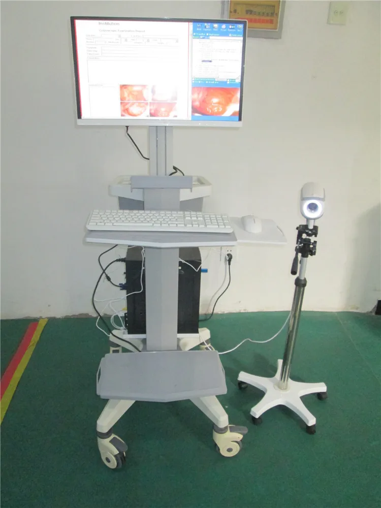 Digital Camera Colposcope Machine/electronic Colposcopy Instrument For ...