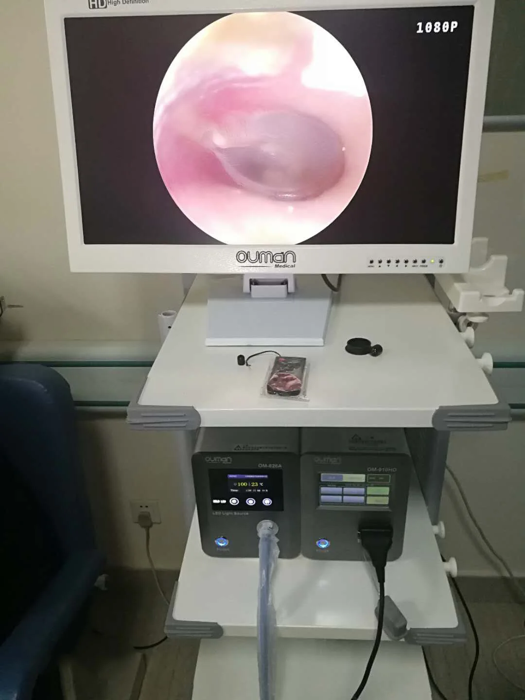 Manufacturer Price Surgical Full Hd Ent Cystoscopy Medical Endoscope ...