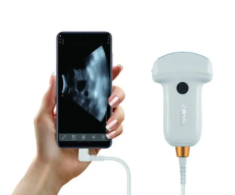 Cow Horse Veterinary Ultrasound Scanner Usb Probe Handheld Ultrasound ...
