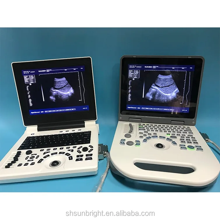 Ultrasound Mini Best Veterinary Usg Ultrasound Scanner - Buy Ultrasound ...