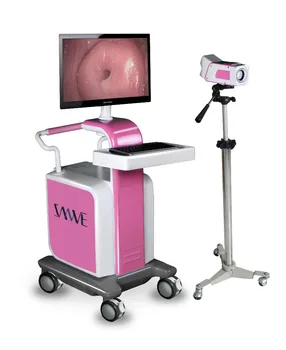High Definition Vagina Inspection Colposcopy Equipment - Buy Colposcopy ...