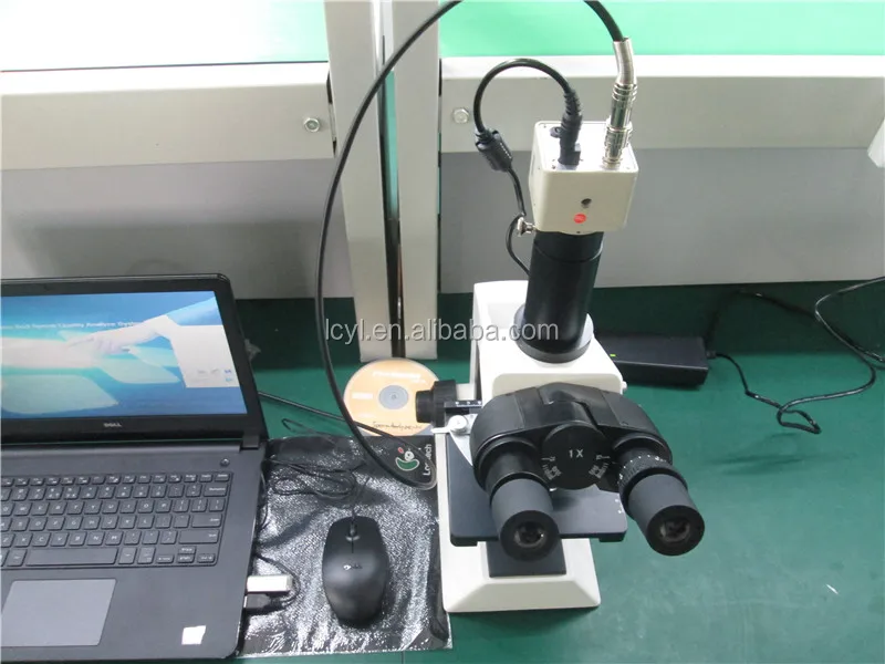 Portable Computer Assisted Semen Analysis Animal Sperm Analyzer Price ...