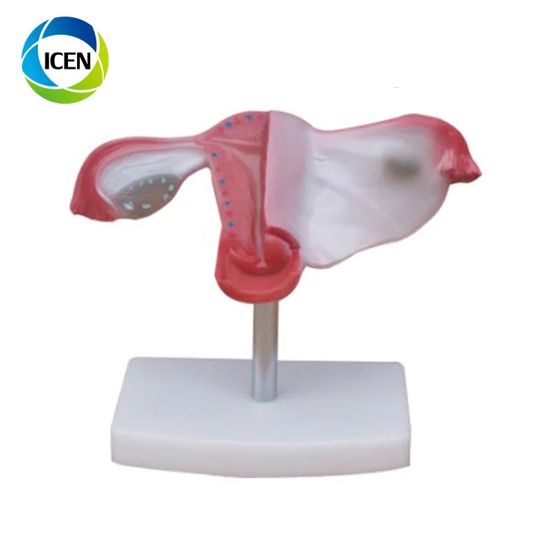 In-403 Human Natural Size Magnified Uterus Model - Buy Uterus Model ...