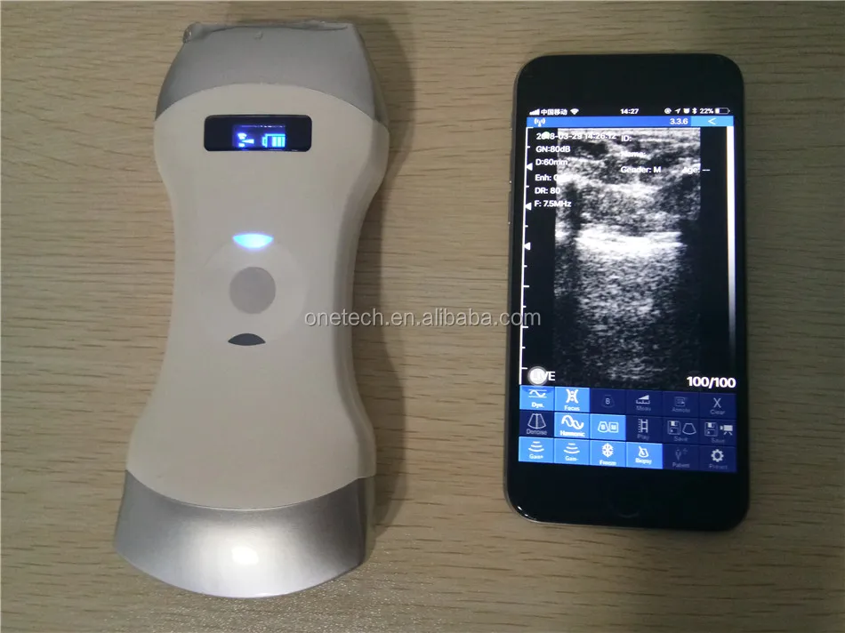 New Designed Dual Heads Wireless Usg Ultrasound Probe For Ios & Ipad ...