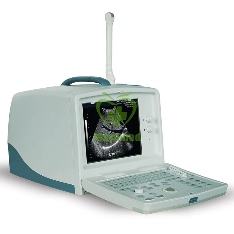 My-a009a Full Digital Pc Ultrasound Scanner Mini Portable Ultrasound ...