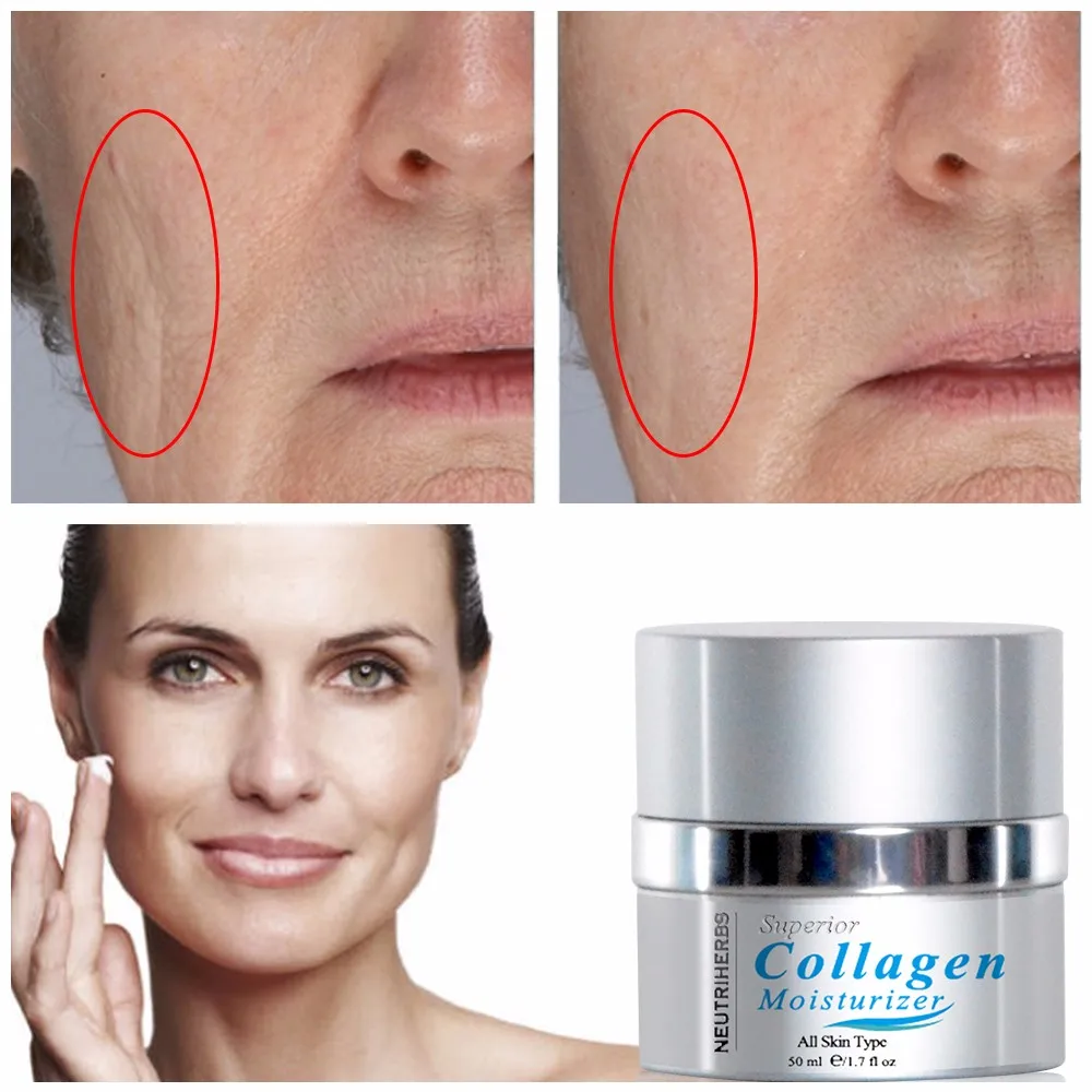 Neutriherbs All Natural Ingredients Snake Venom Free Wrinkle Cream For ...