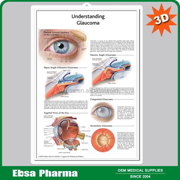 3D Medical Anatomical Wall Chart for Understanding Glaucoma| Alibaba.com