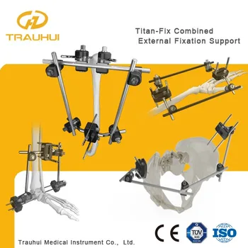 Combined External Fixator Orthopedic Implant Orthofix Hoffman External ...