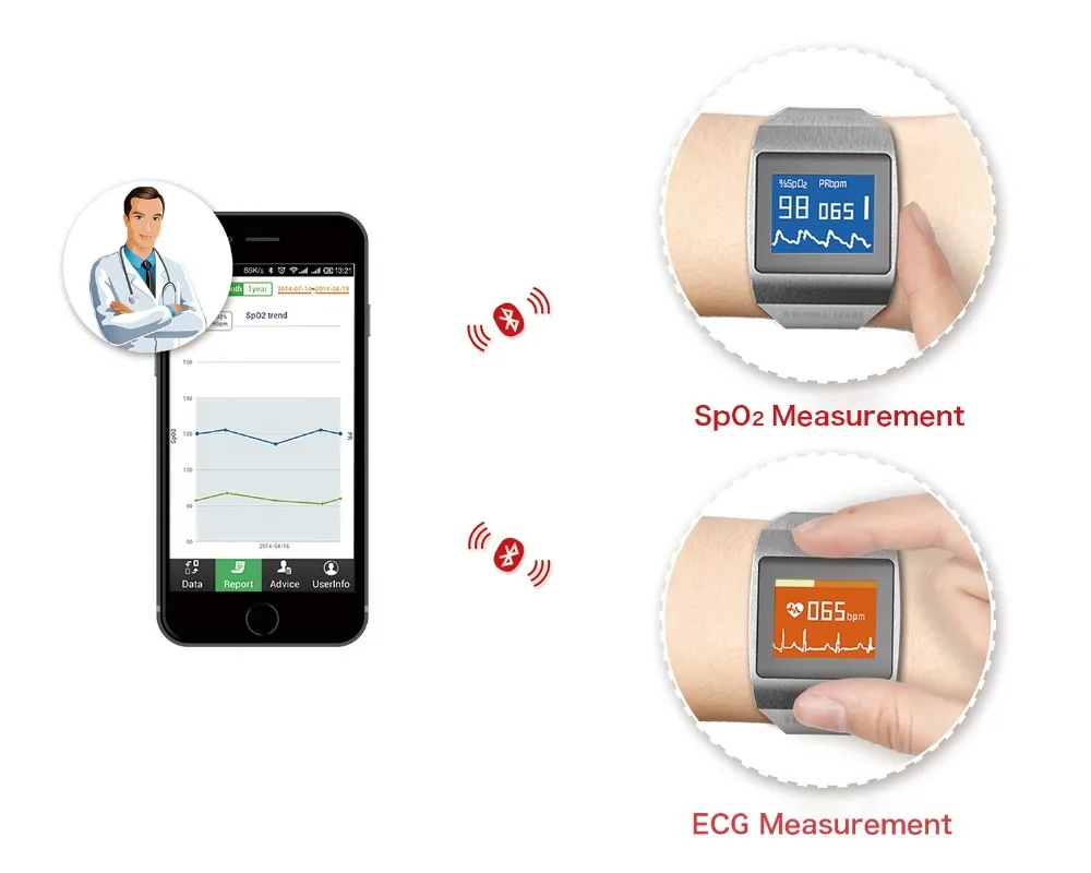 CMS50K Portable Device - Smart Watch ECG Holter Monitor