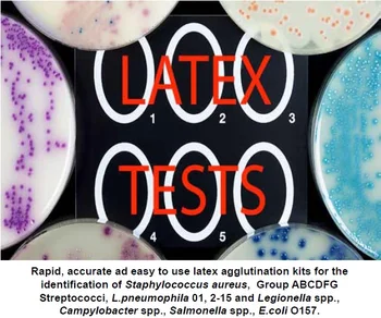 Salmonella Latex Identification Test - Buy Latex Bacterial Colony ...