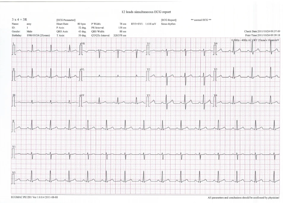 Pc Ecg/ekg Machine Compatible With Windows 10 System - Buy Pc Ecg,Pc ...