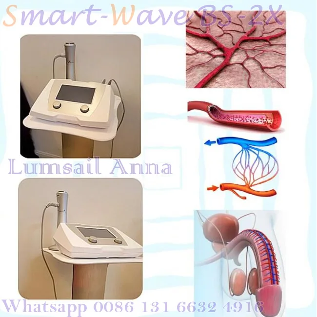 Extracorporeal Pulse Activation Technology Shock Wave Therapy Machine ...
