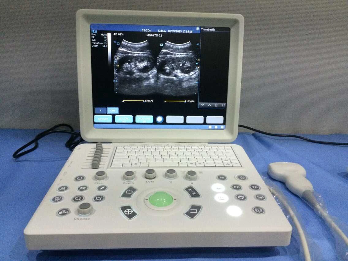 MSLPU33 - Portable Ultrasound Scanner for Medical Echography