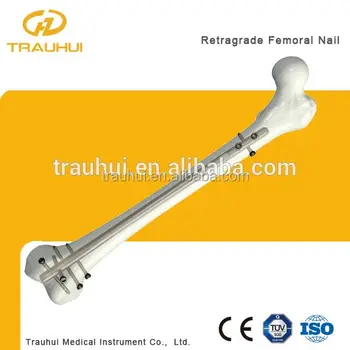 Retrograde Femoral Nail Orthopedic Instrument Implant Intramedullary ...