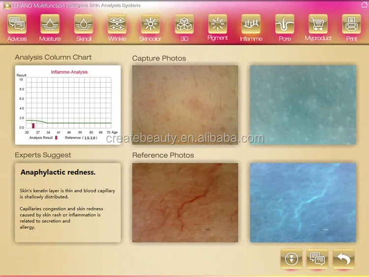 Skin Hair Analyzer - Portable Dermatoscope for Acne & Wrinkles