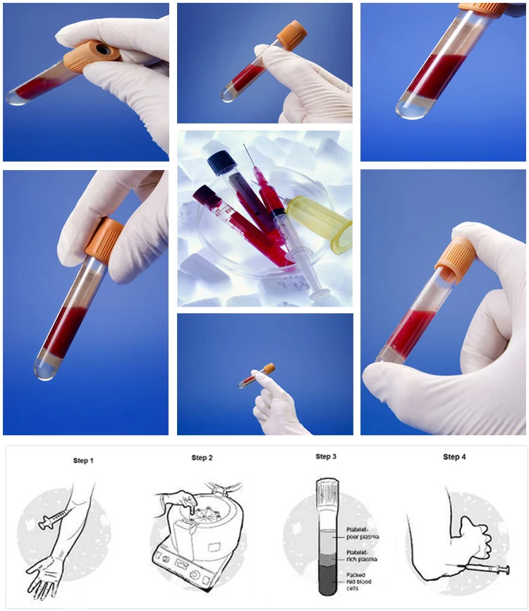 Bd Vacutainer Blood Collection Tubes Heparin Additive Vacuum Blood Test ...