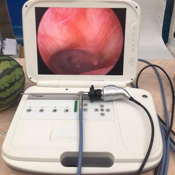 Integrated Nasal Endoscopic Hd Camera - Buy Endoscopic Camera ...