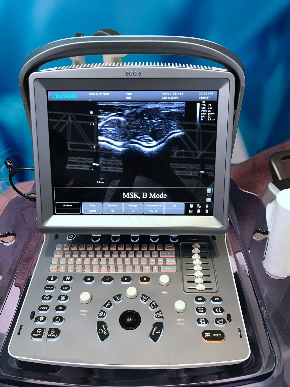 Excellent Quality Chison Eco5 Portable Color Doppler Ultrasound/long ...