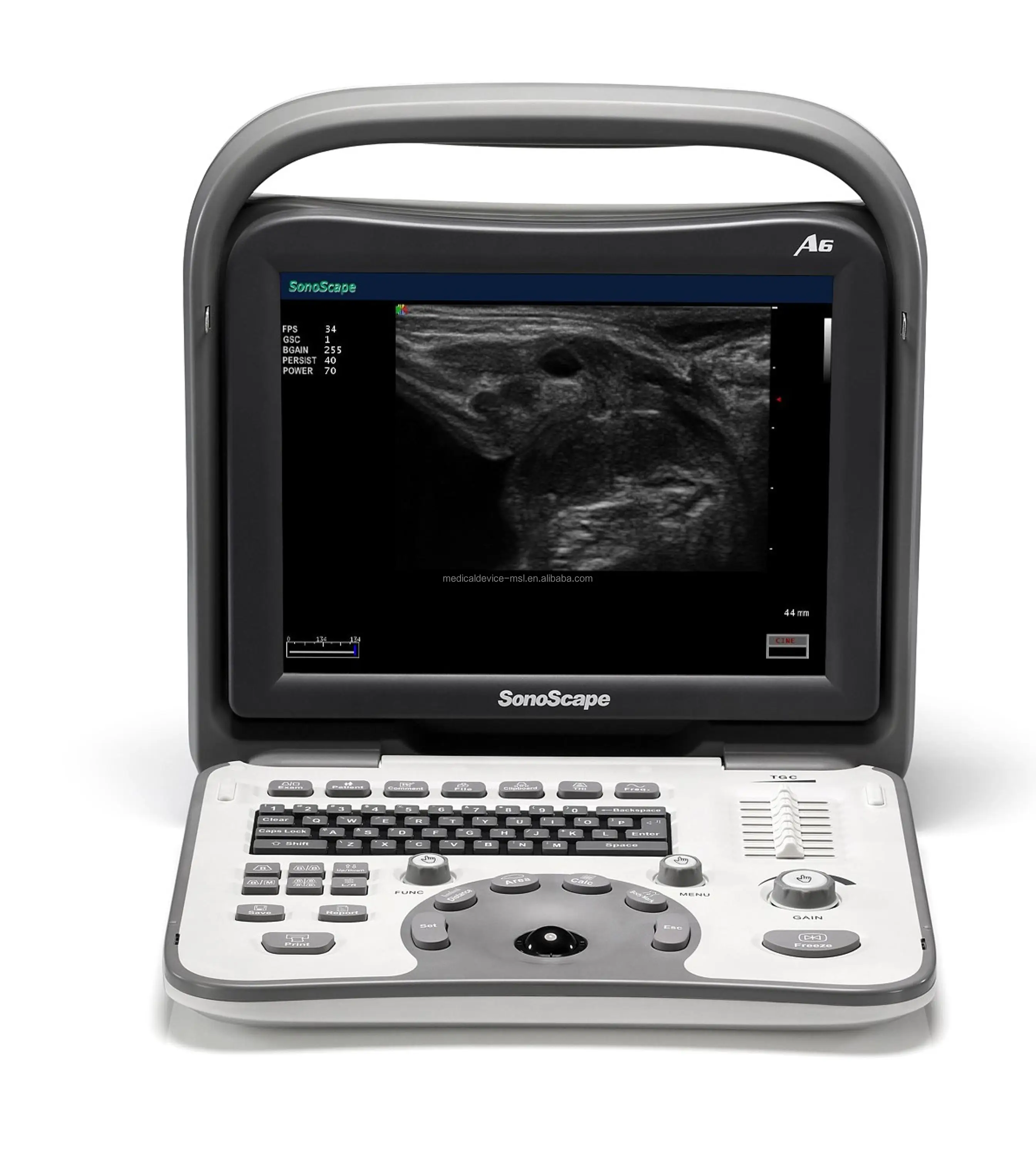 Black & White Portable Ultrasound Machine Sonoscape A6 With Built-in ...