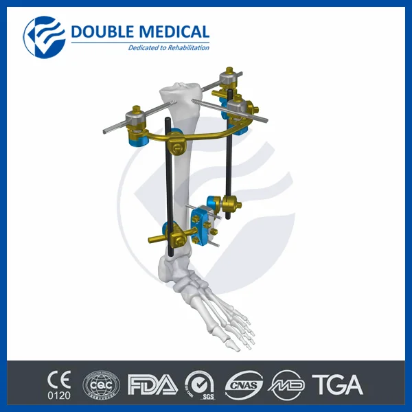 Ce Carbon Fiber Tibial Fixator External Fixation System Orthopedic ...