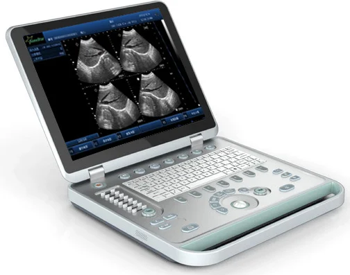 Portable Echo Ultrasound/cardiac Ultrasound Equipment