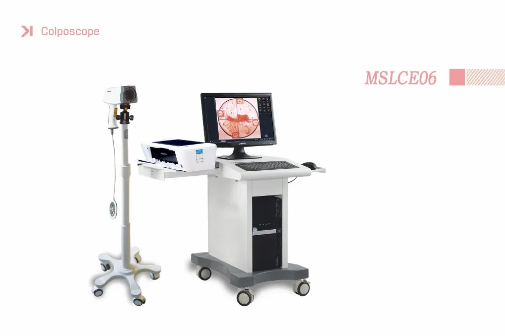 Hot Sale Full Digital Colposcopel Camera /hd Digital Colposcope For ...